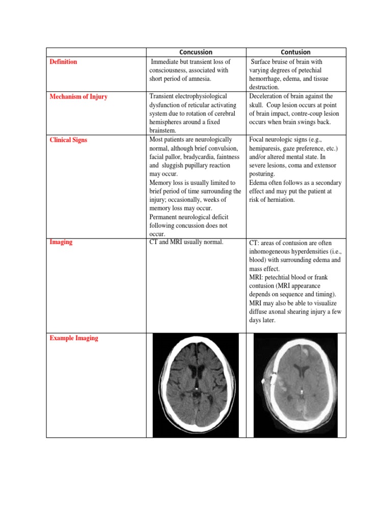 Concussion vs. Contusion: Key Differences | PDF | Concussion | Neuroscience