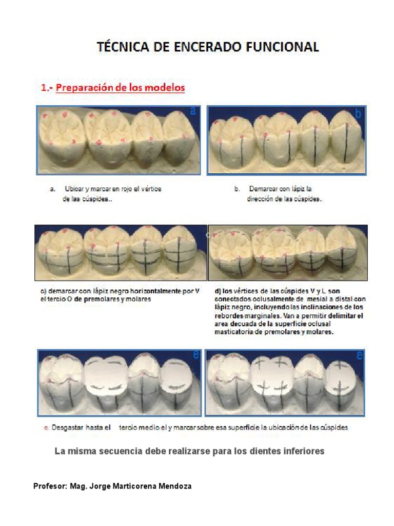 Técnica de Encerado Funcional PDF | PDF