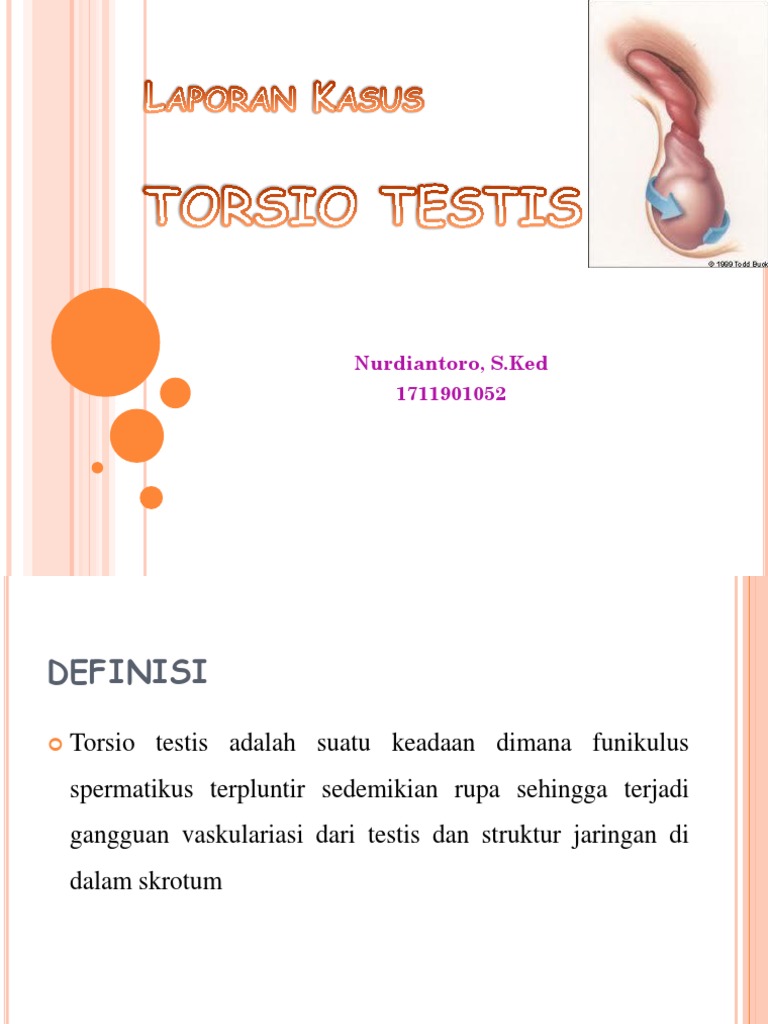 Torsio Testis | PDF