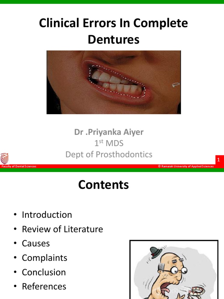 Clinical Errors in Complete Dentures | PDF | Dentures | Tooth