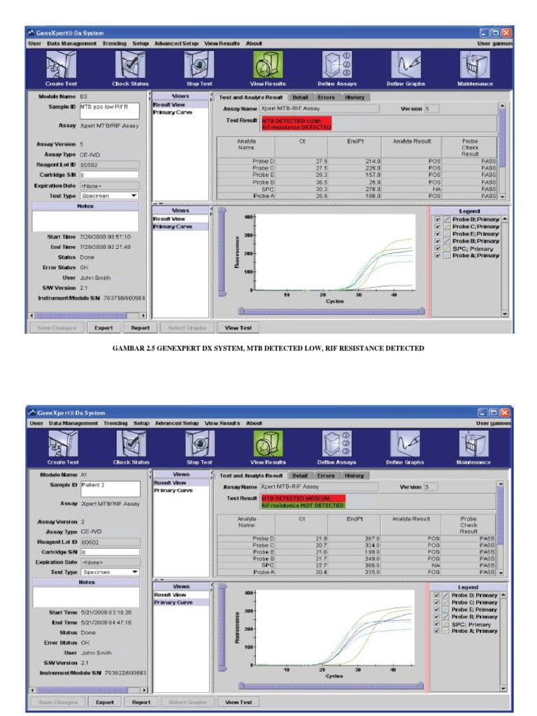 MTB Detection and Rif Resistance Levels | PDF