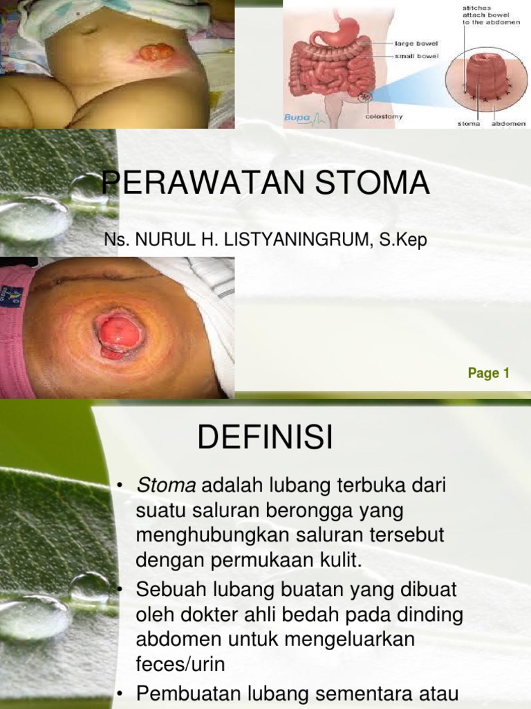 Perawatan Stoma Unikal | PDF