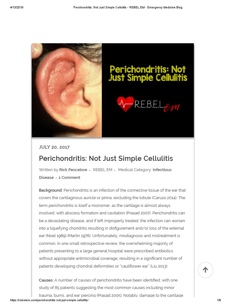 Perichondritis - Not Just Simple Cellulitis - REBEL EM - Emergency ...