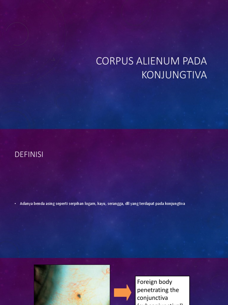 Corpus Alienum Pada Konjungtiva | PDF