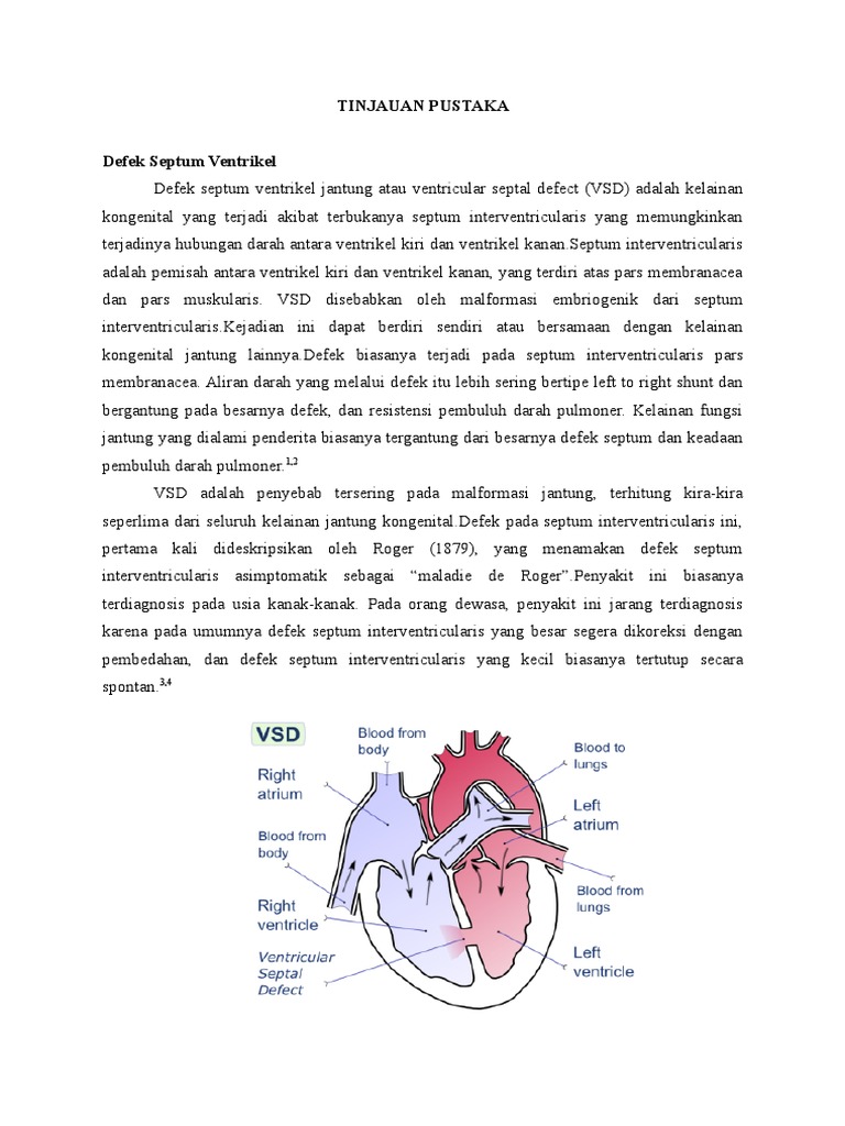 Defek Septum Ventrikel VSD | PDF