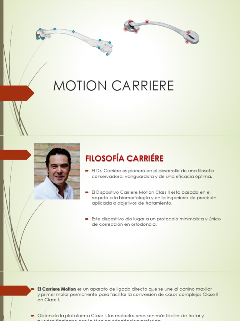 Motion Carriere | PDF | Ortodoncia | Odontología