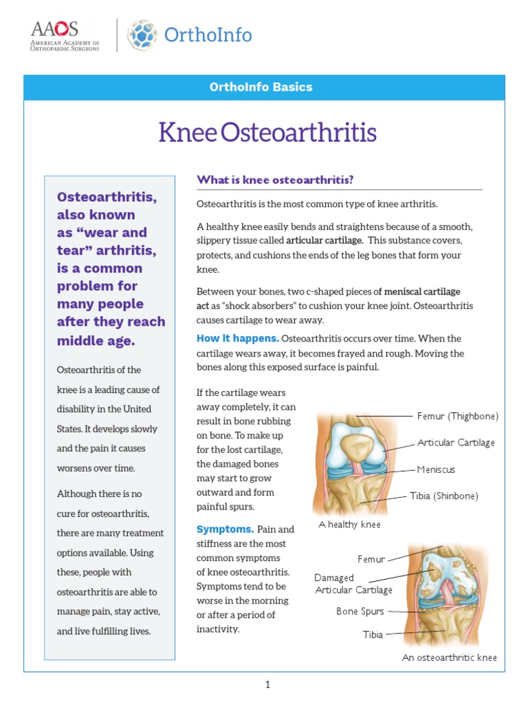 Knee Osteoarthritis Pdf Pdf Osteoarthritis Knee