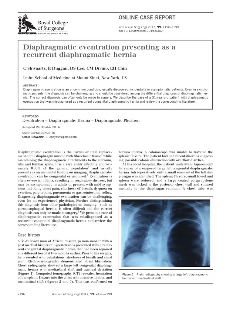 Diaphragmatic Eventration Presenting As A Recurrent Diaphragmatic ...