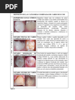 Códigos y criterios ICDAS de caries | PDF | Esmalte de dientes | Diente