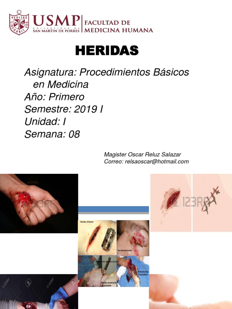 pbm7 (Heridas) PDF | PDF | Herida | Inflamación