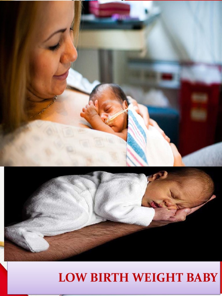 Low Birth Weight Baby | PDF | Low Birth Weight | Infants