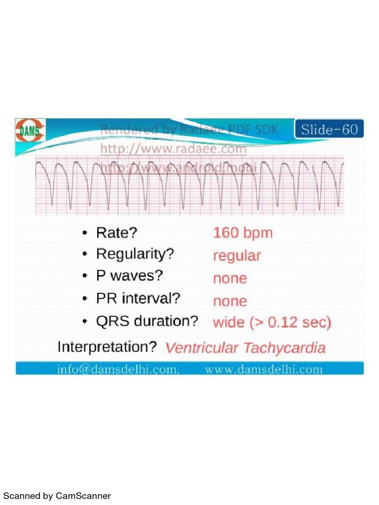 ECG Notes | PDF