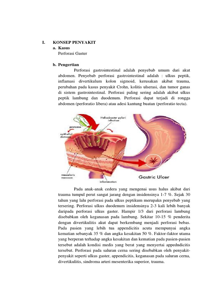 LP Perforasi Gaster KONSEP PENYAKIT | PDF