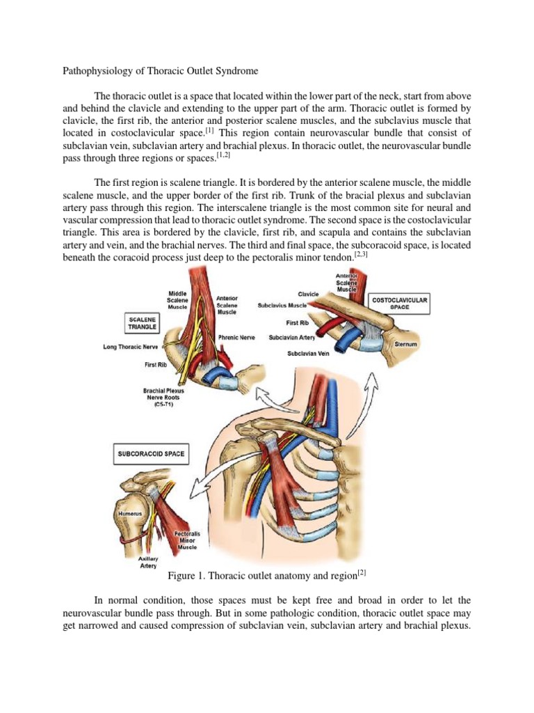 Pathophysiology of Thoracic Outlet Syndrome | PDF | Limbs (Anatomy ...