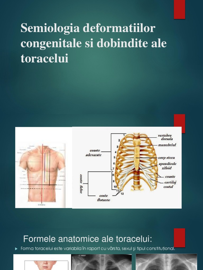 Deformarile Cutiei Toracice | PDF