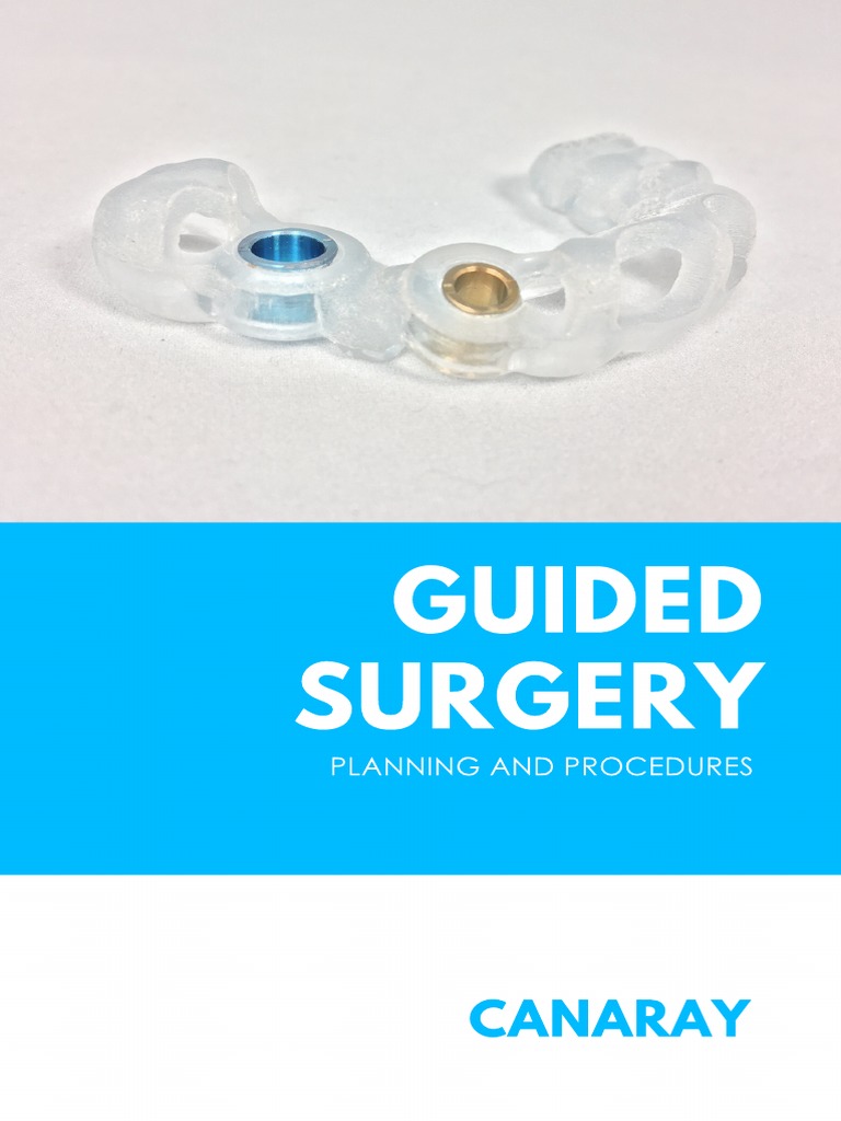 Canaray Guided Surgery Brochure PDF | PDF