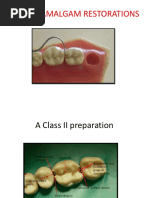 Monoplane Occlusion Summary Review | PDF | Dentures | Tooth