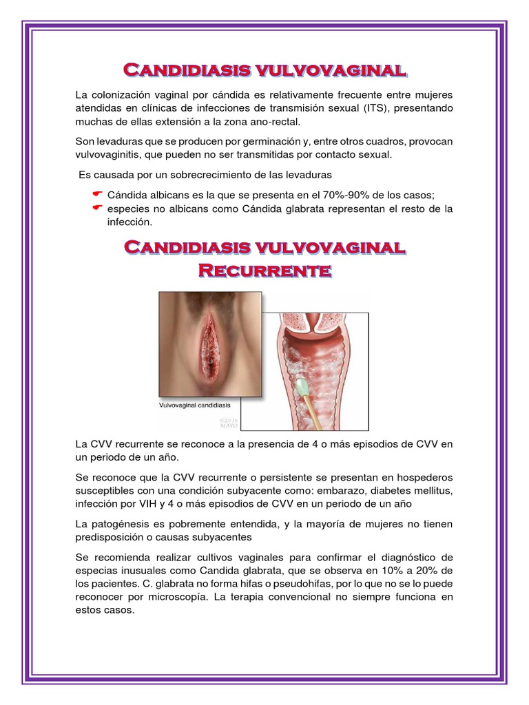 Candidiasis vulvovaginal store