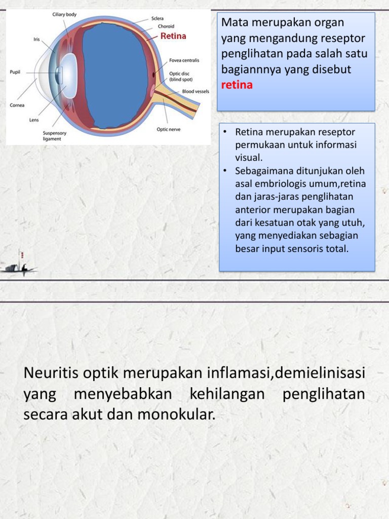 Neuritis Optik | PDF