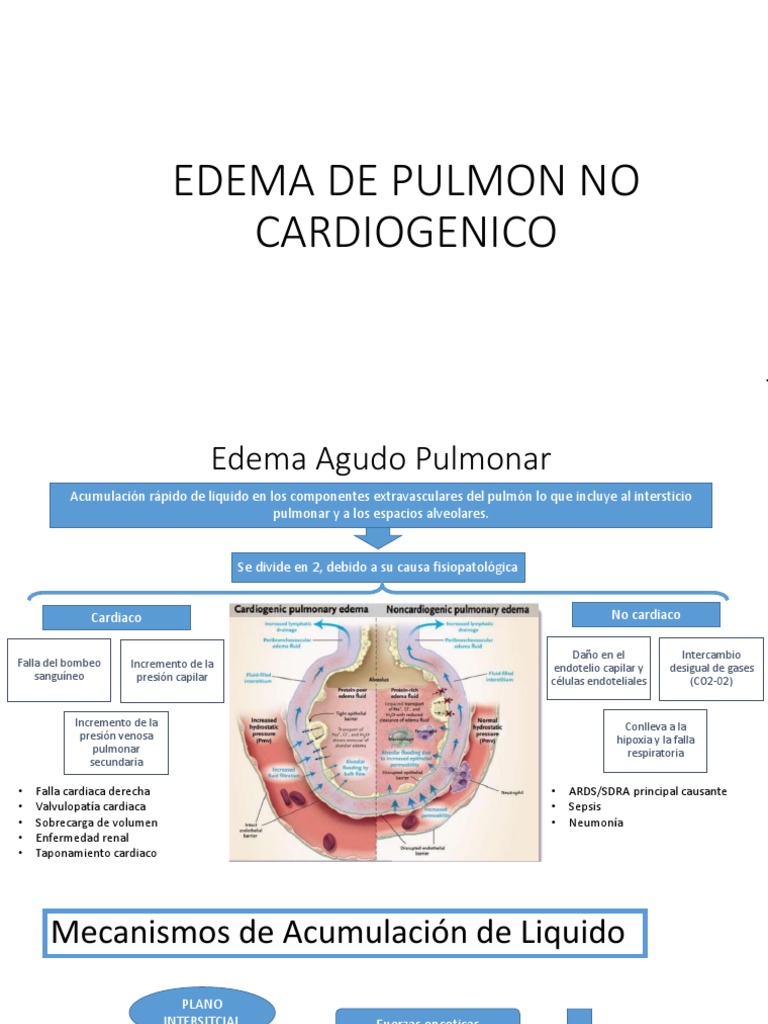 Edema De Pulmon No Cardiogenico | Edema | Capilar