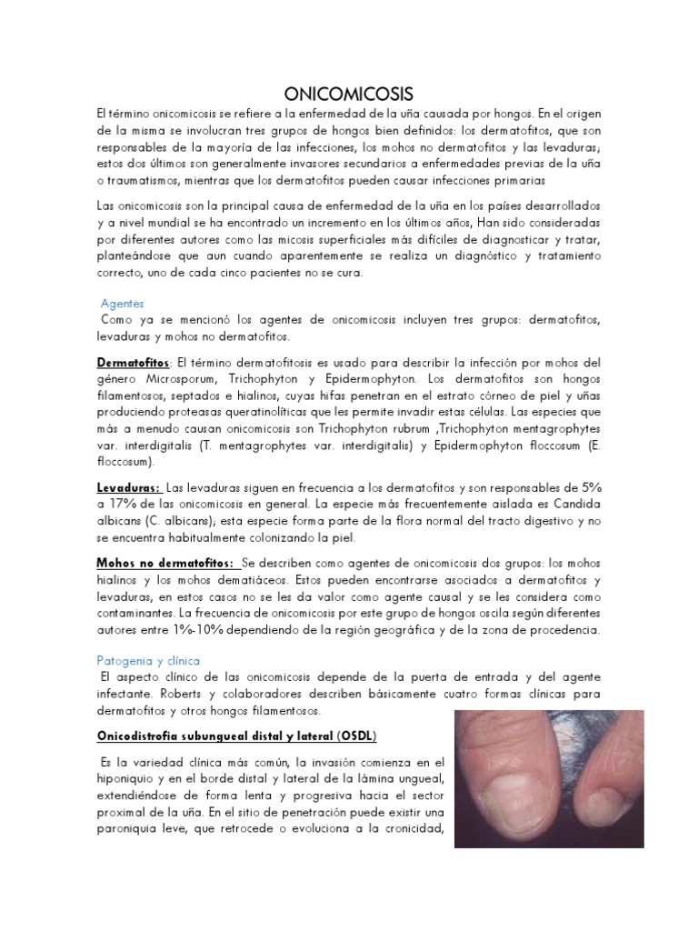 Onicomicosis: Causas y Tratamientos | PDF | Condiciones cutáneas ...