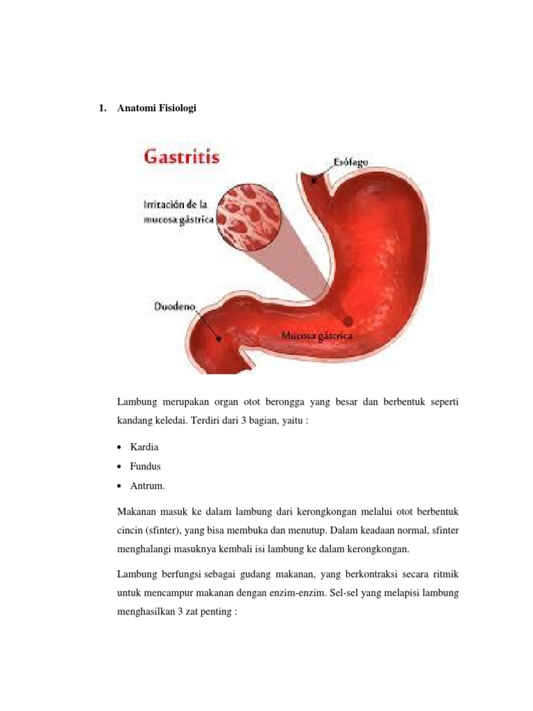 LP Gastritis | PDF