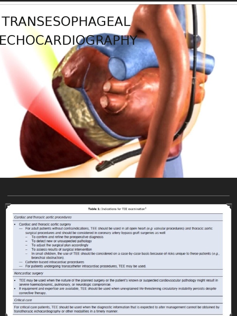A Guide to Transesophageal Echocardiography Probe Placement and ...