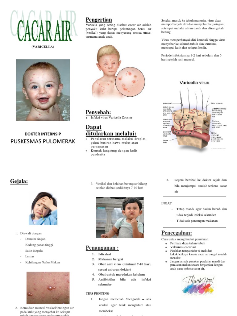 Leaflet Cacar Air | PDF