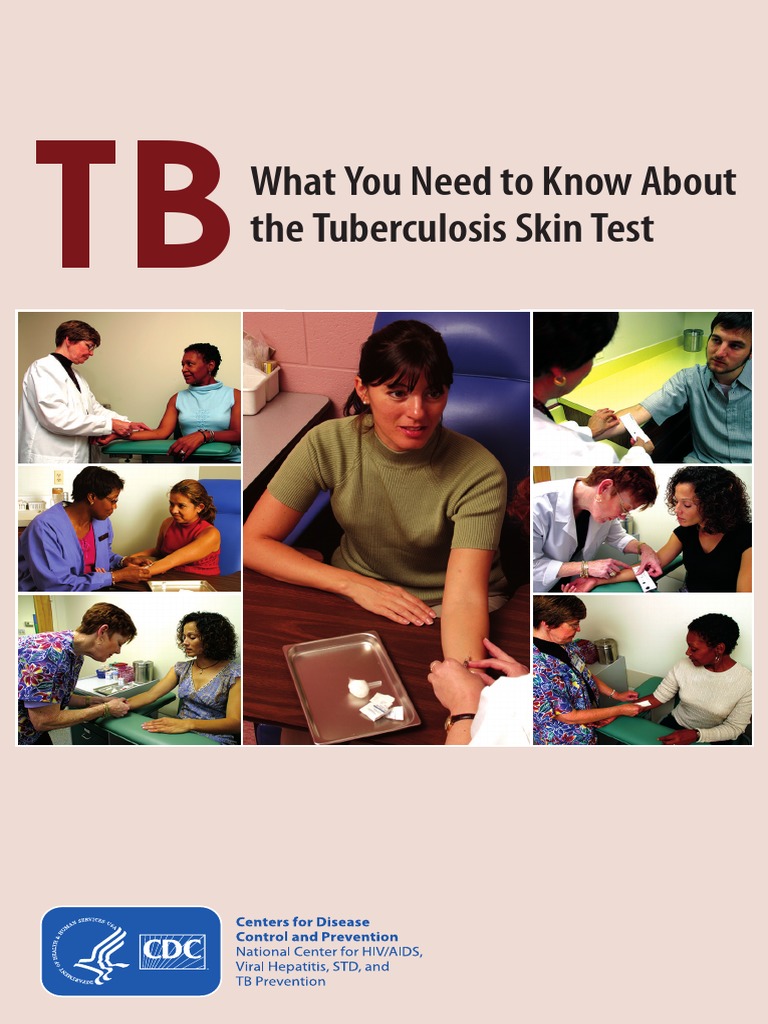 What You Need To Know About The Tuberculosis Skin Test | PDF ...