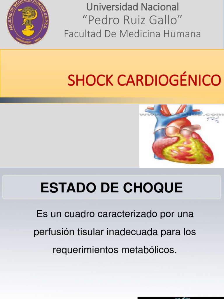 Shock Cardiogénico | PDF | Choque (circulatorio) | Especialidades Medicas