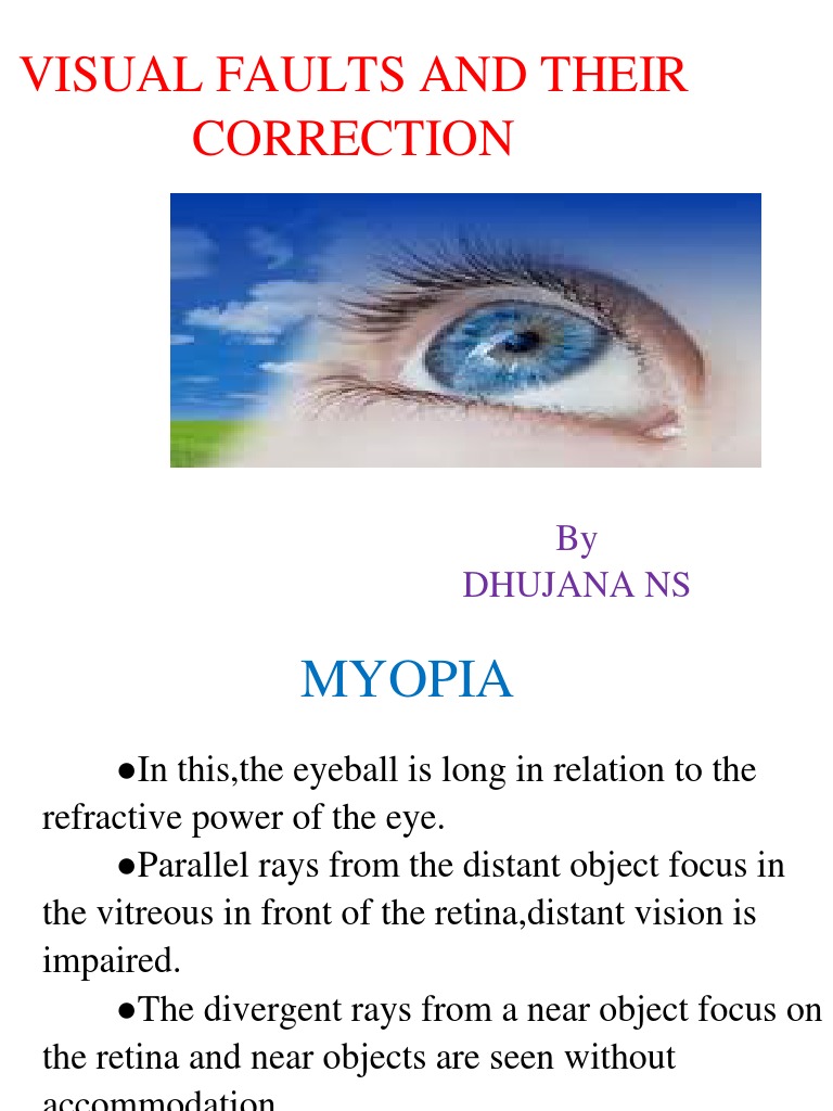 Eye Defects | Human Eye | Eye