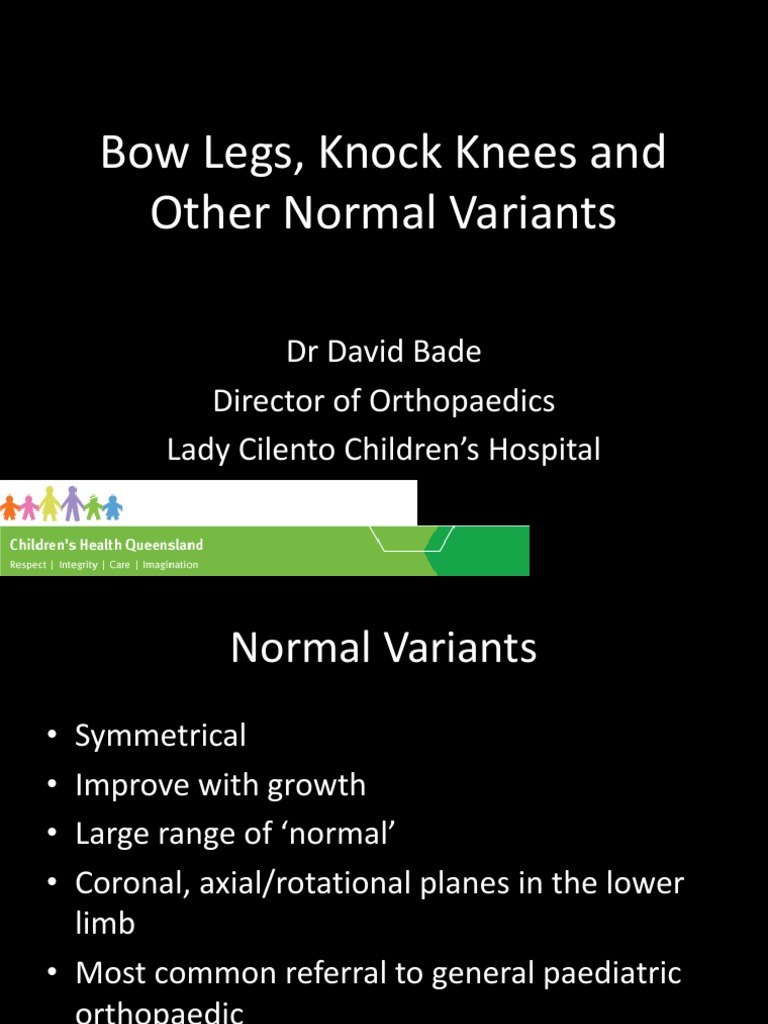 Bow Legs, Knock Knees and Other Normal Variants: DR David Bade Director ...