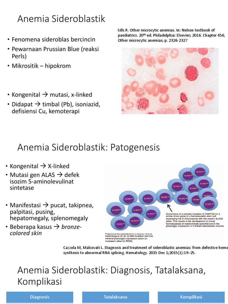 Anemia Sideroblastik: - Fenomena Sideroblas Bercincin - Pewarnaan ...