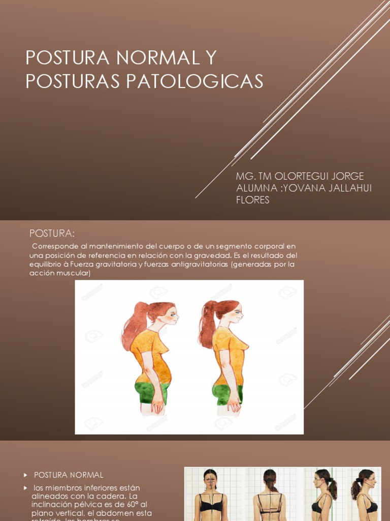 Postura Normal y Posturas Patologicas | Descargar gratis PDF | La ...