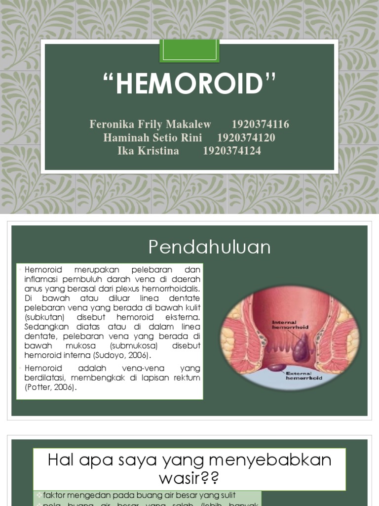 Hemoroid | PDF