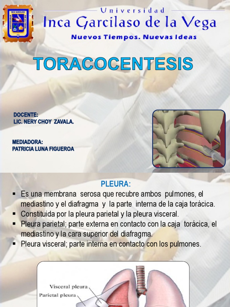 Toracocentesis PPT - Expo | PDF | Medicina CLINICA | Especialidades Medicas