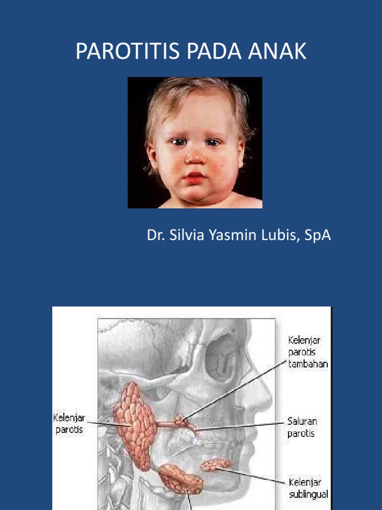 Tatalaksana Parotitis pada Anak | PDF | Kesehatan Holistik | Sains ...