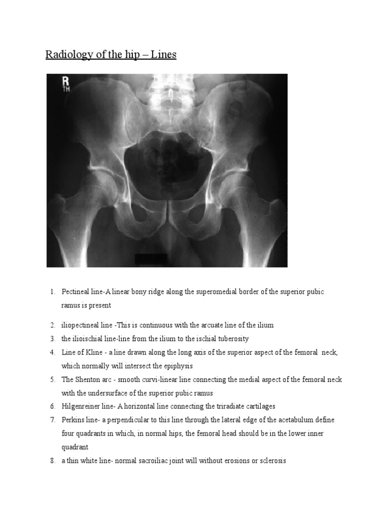 Radiology of The Hip | PDF | Hip | Pelvis