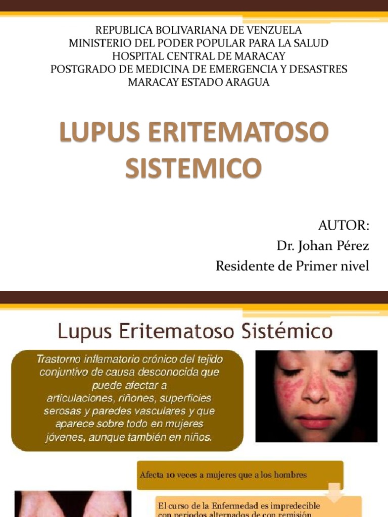 Presentación 1 | PDF | Lupus eritematoso sistémico | Rtt