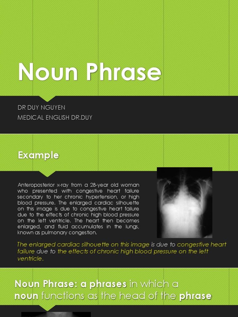 Noun Phrase Structure Explained | PDF