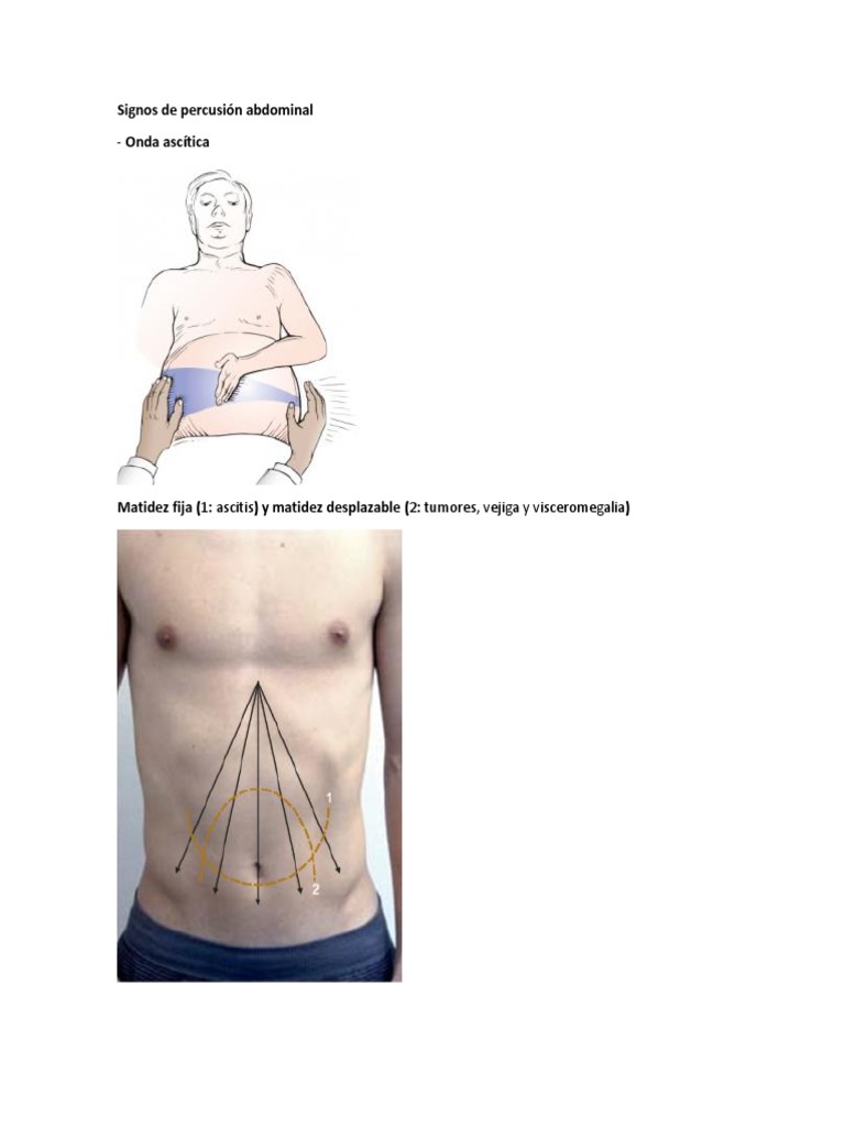 Signos de Percusión Abdominal y Ascitis | PDF | Ciencias sociales | Arte