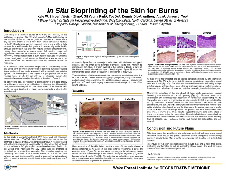 In Situ Skin Bioprinting for Burns | PDF | Scar | Skin
