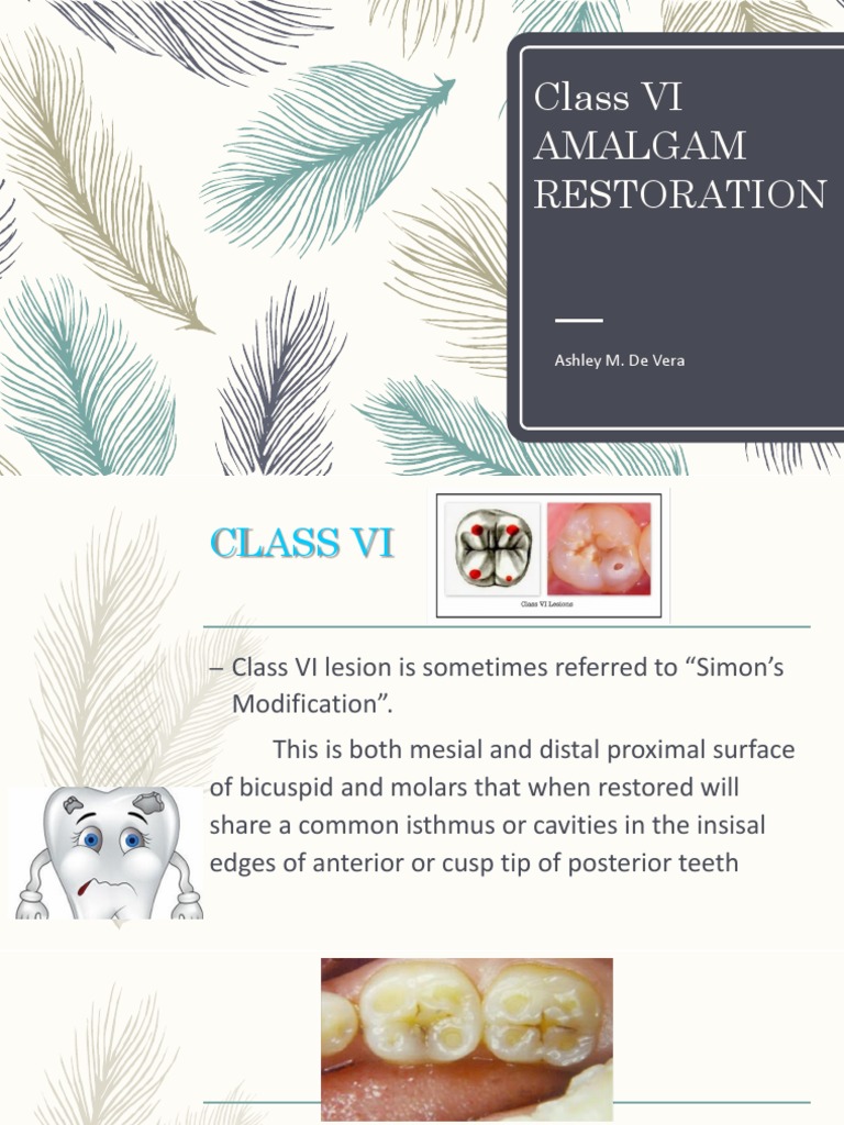 Amalgam Class Vi | PDF | Tooth Enamel | Tooth