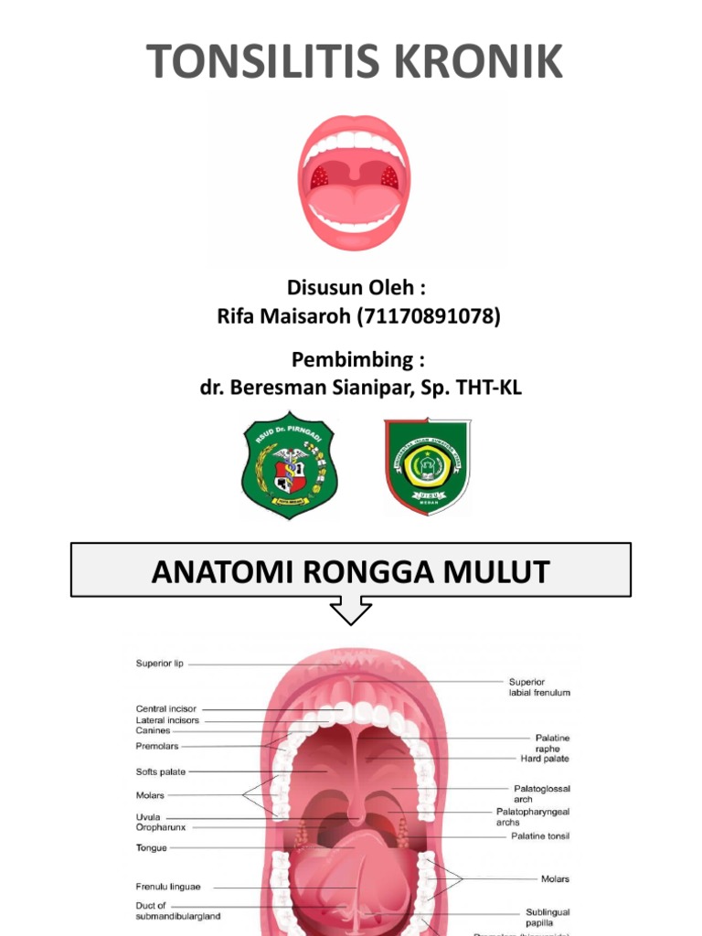 TONSILITIS KRONIK MENYEBABKAN PEMBESARAN TONSIL | PDF