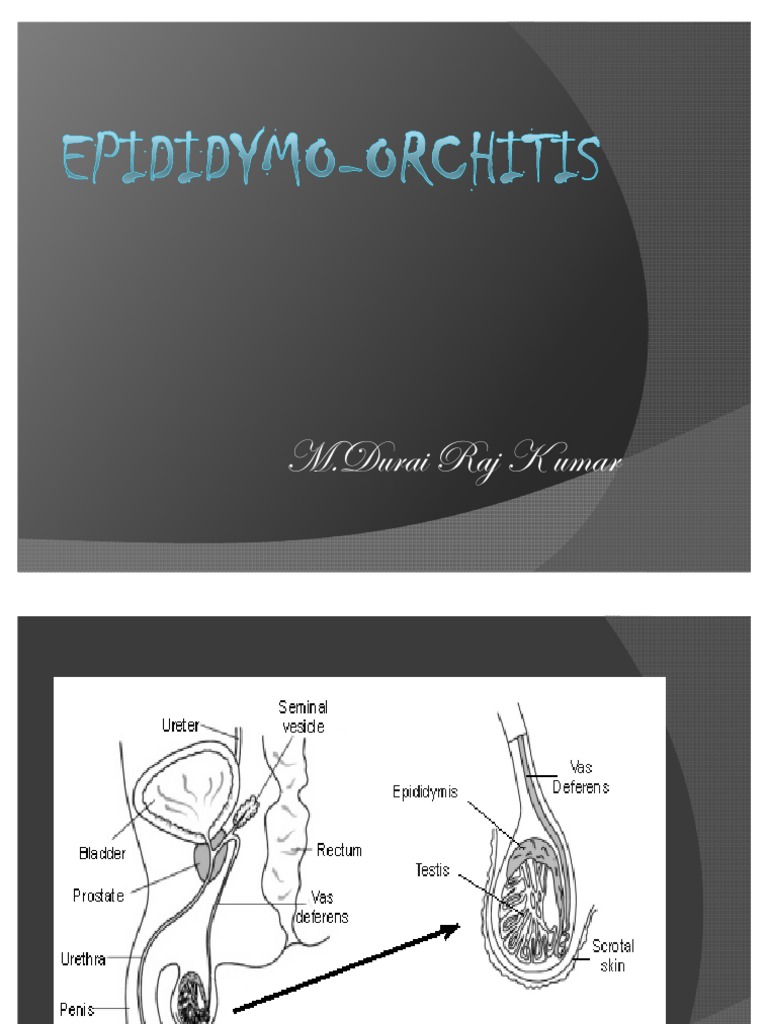 Epididymo Orchitis Medical Specialties Public Health