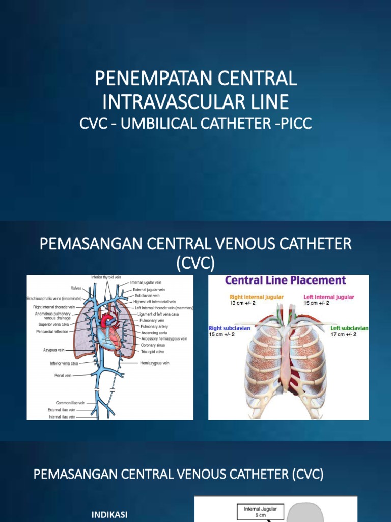 Penempatan Central Intravascular Line-1 | PDF