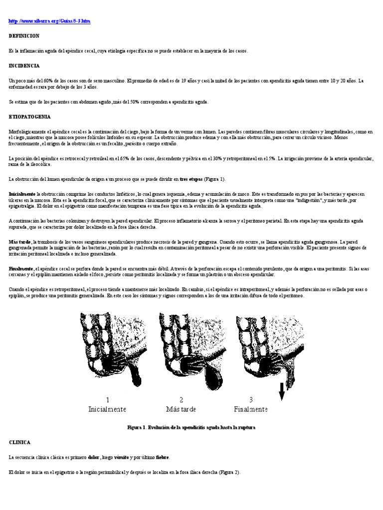 Apend I+ Perito | PDF | Peritoneo | Abdomen