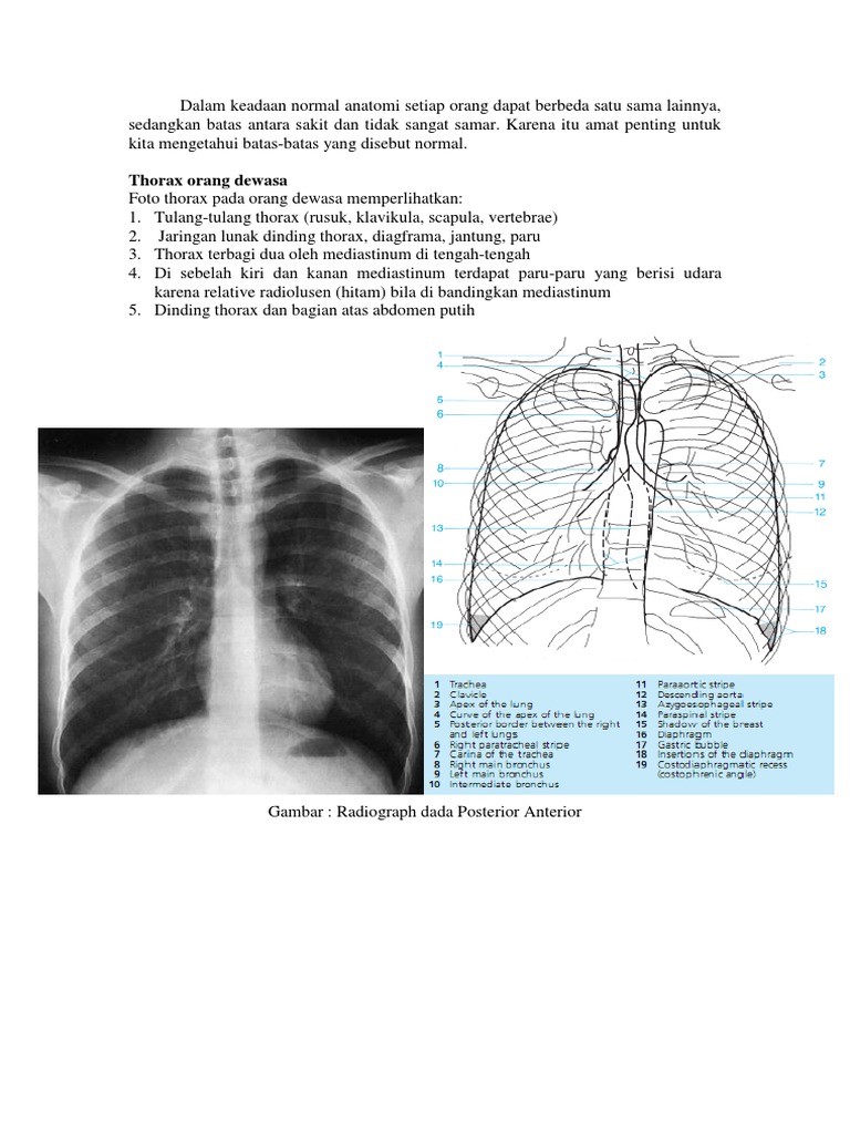 Anatomi Radiologi | PDF