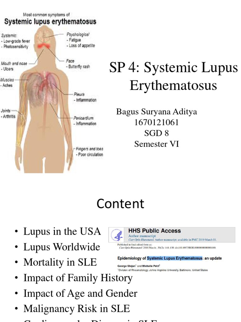 SP 4: Systemic Lupus Erythematosus: Bagus Suryana Aditya 1670121061 SGD ...