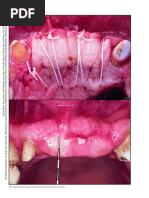 Clinical Update: The Deficient Alveolar Ridge: Classification and ...